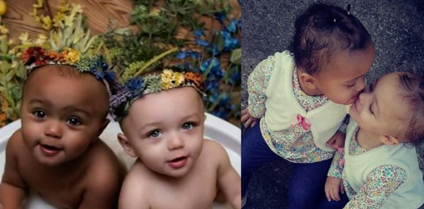 Rare biracial twins prove that love knows no color: “You can’t look at ...