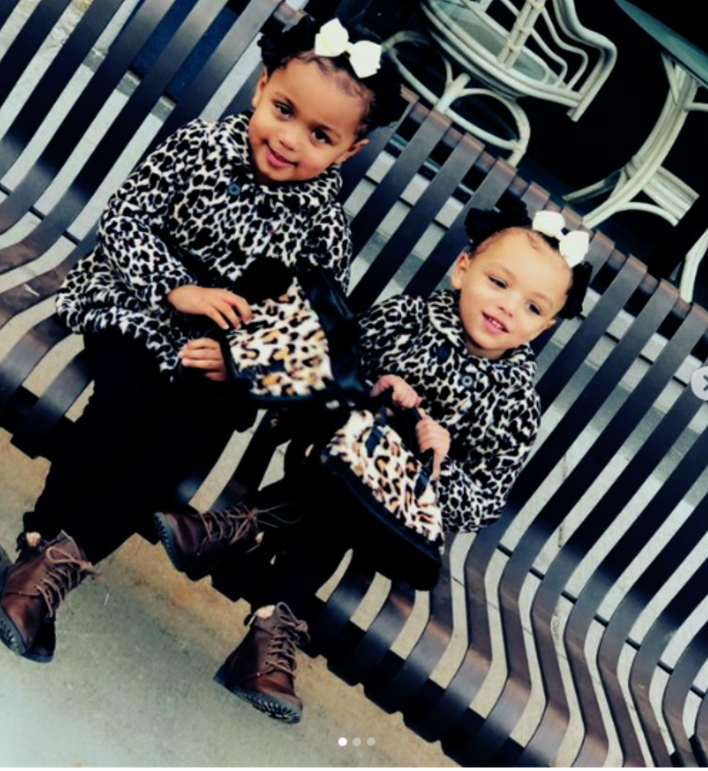 Rare biracial twins prove that love knows no color: “You can’t look at ...